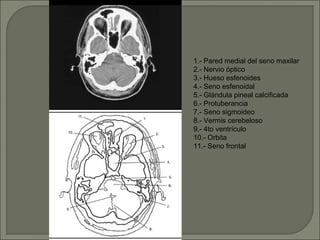 Manual de anatomia de cabeza primera parte | PPT