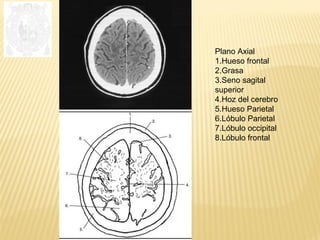 Anatomia tomográfica -cráneo | PPT