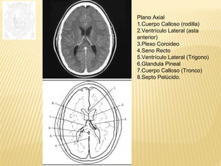 Anatomia tomográfica -cráneo | PPT