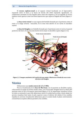 MANUAL DE ECOGRAFIA CLINICA. Casasola (1).pdf