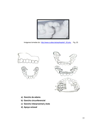 Manual de ortodoncia por andrea berrios | PDF