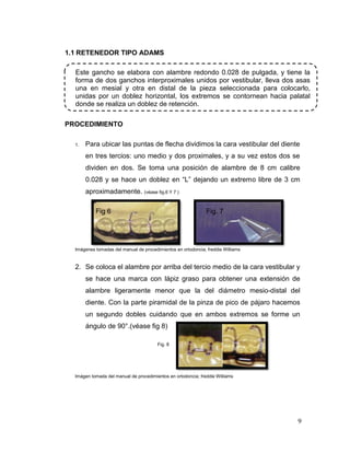 Manual de ortodoncia por andrea berrios | PDF