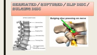 Manual handling presentation | PPTX