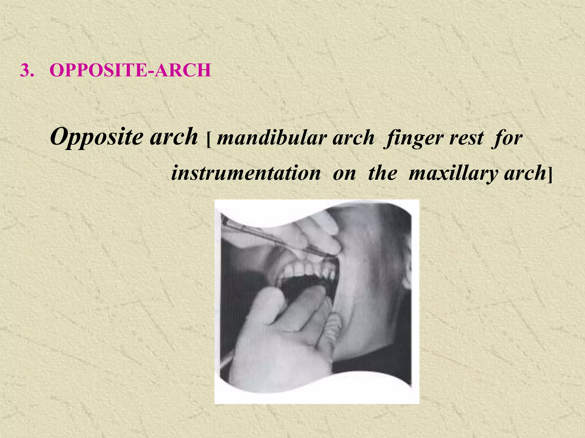 MANUAL INSTRUMENTATION.ppt
