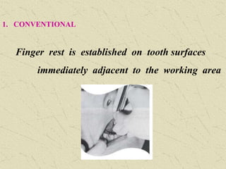 MANUAL INSTRUMENTATION.ppt