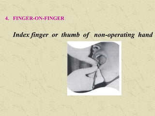 MANUAL INSTRUMENTATION.ppt