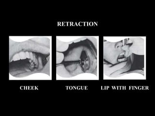 MANUAL INSTRUMENTATION.ppt