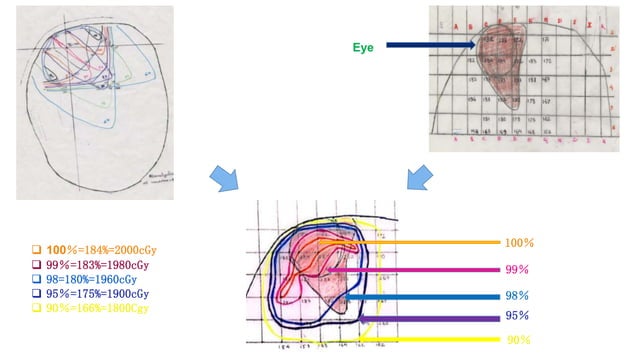 MANUAL ISODOSE PLOTTING.pptx