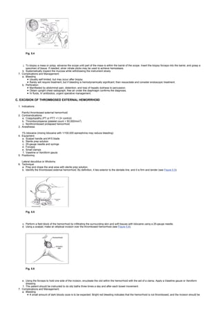 Manual of common bedside surgical procedures 2ed | PDF