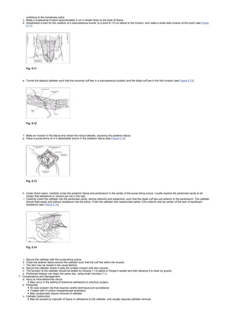 Manual of common bedside surgical procedures 2ed | PDF