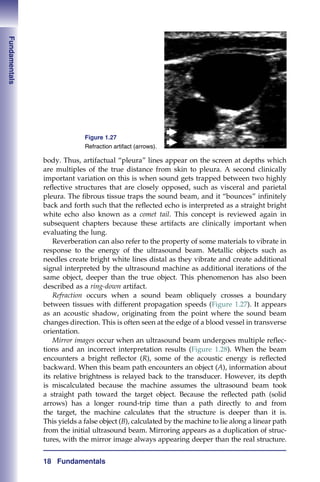 Manual of Emergency and Critical Care Ultrasound - Vicki Noble.pdf