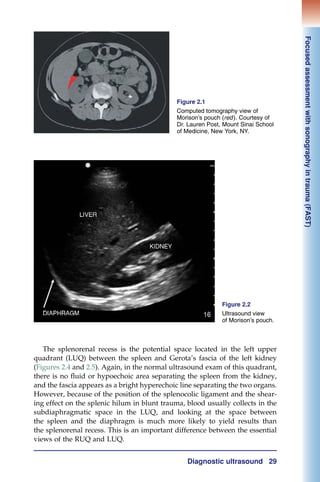 Manual of Emergency and Critical Care Ultrasound - Vicki Noble.pdf