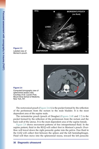 Manual of Emergency and Critical Care Ultrasound - Vicki Noble.pdf