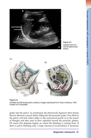 Manual of Emergency and Critical Care Ultrasound - Vicki Noble.pdf