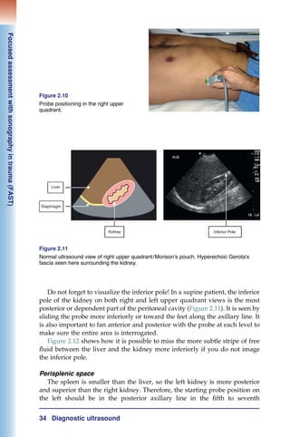 Manual of Emergency and Critical Care Ultrasound - Vicki Noble.pdf