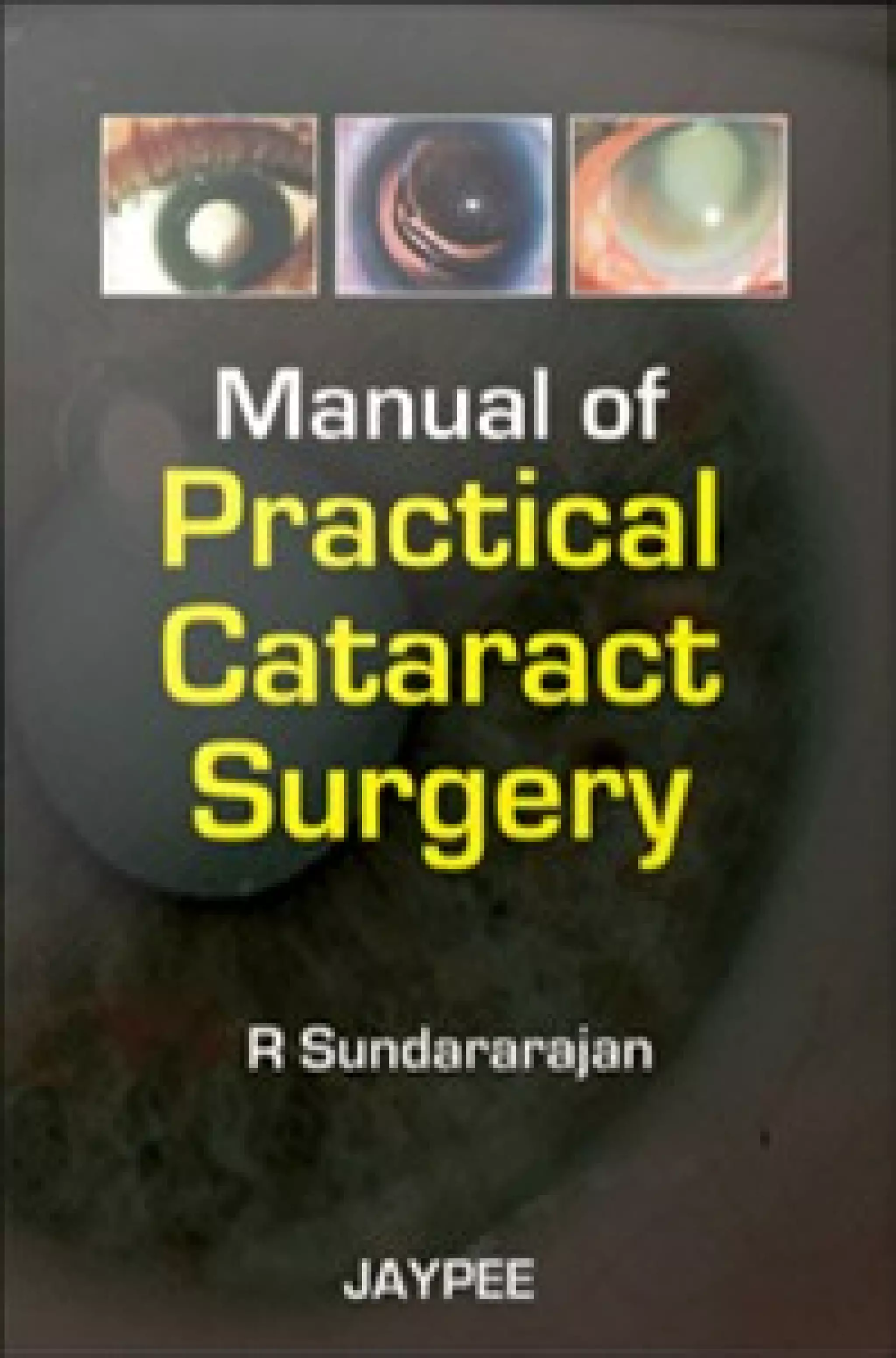 Manual of Practical Cataract Surgery.pdf