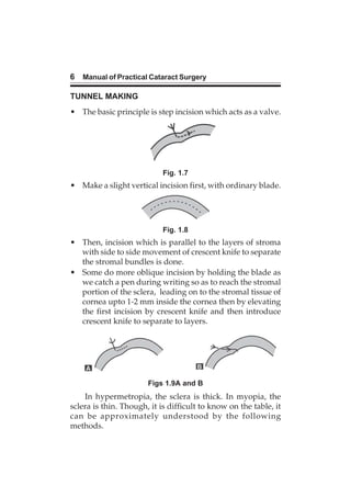 Manual of Practical Cataract Surgery.pdf
