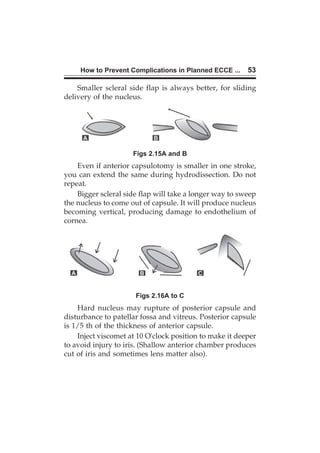 Manual of Practical Cataract Surgery.pdf
