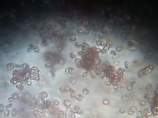 Manual polybrene | PPT