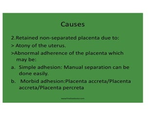 Manual removal of placenta | PPT