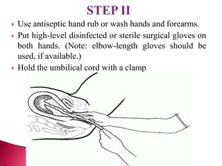 Manual removal of placenta.pptx