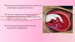 Manual removal of placenta.pptx | Pregnancy | Reproductive Health