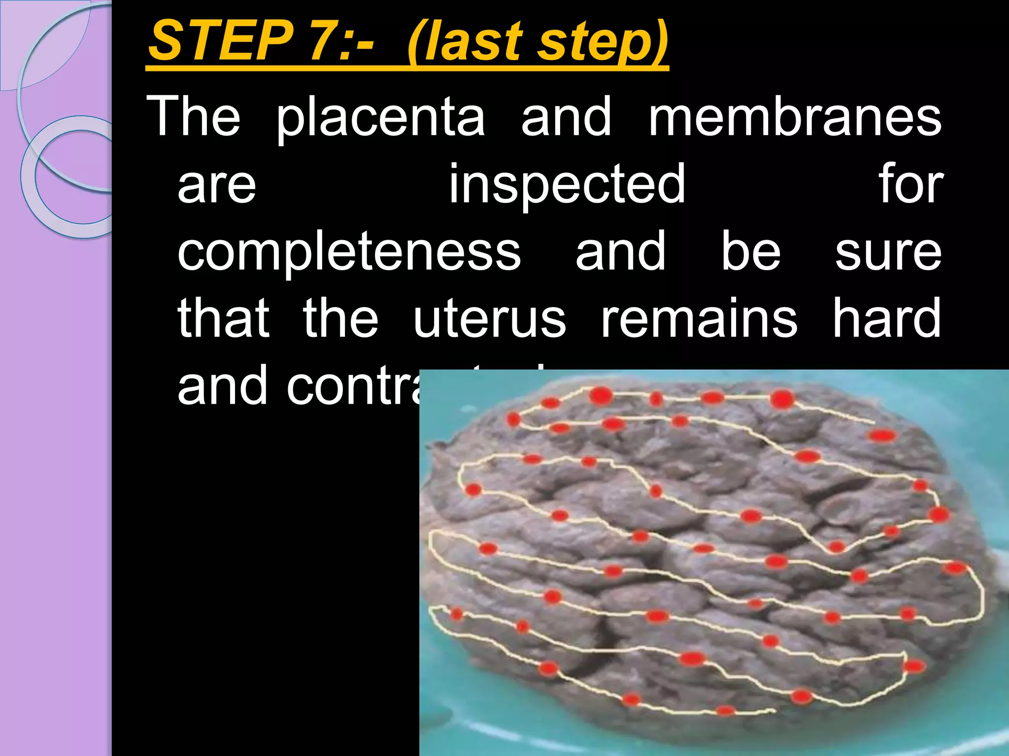 Manual removal of placenta (1 | PPTX