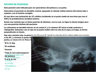 Manualrx03 Oido | PPT
