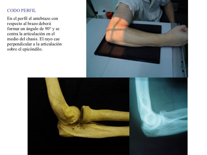 Manualrx06 Miembro Superior