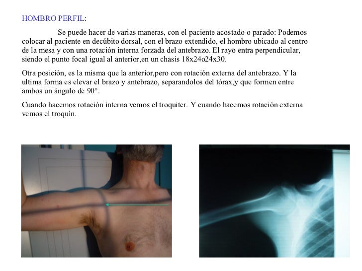 Manualrx06 Miembro Superior