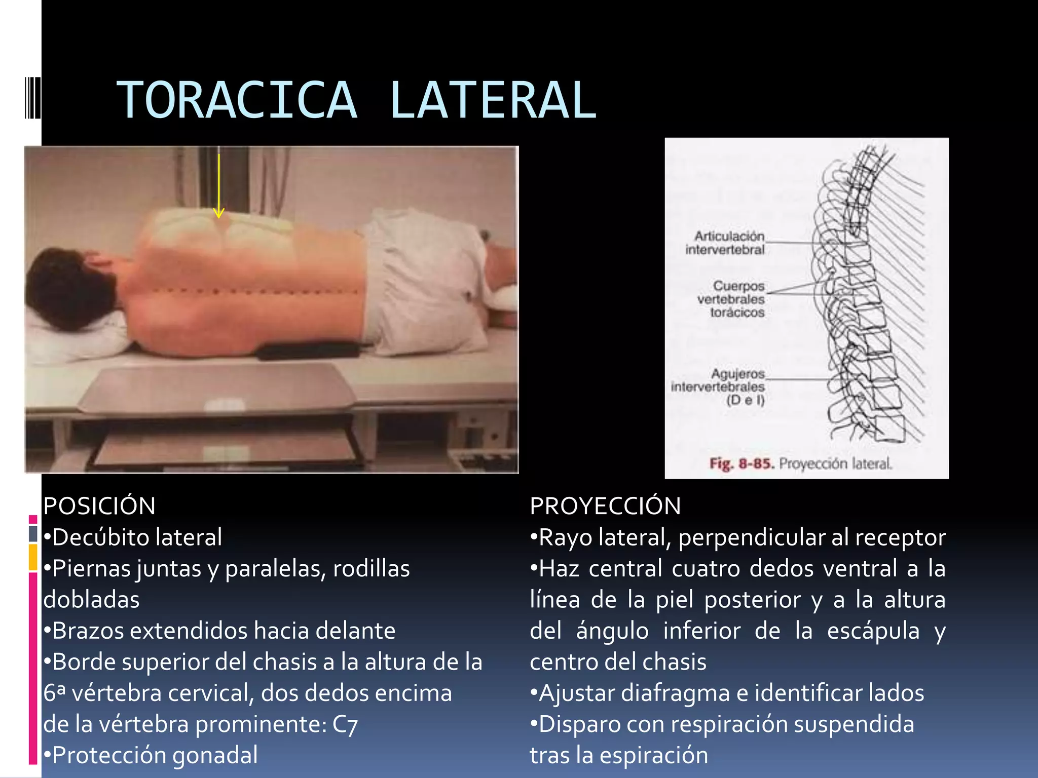 Manual rx columna vertebral | PPTX