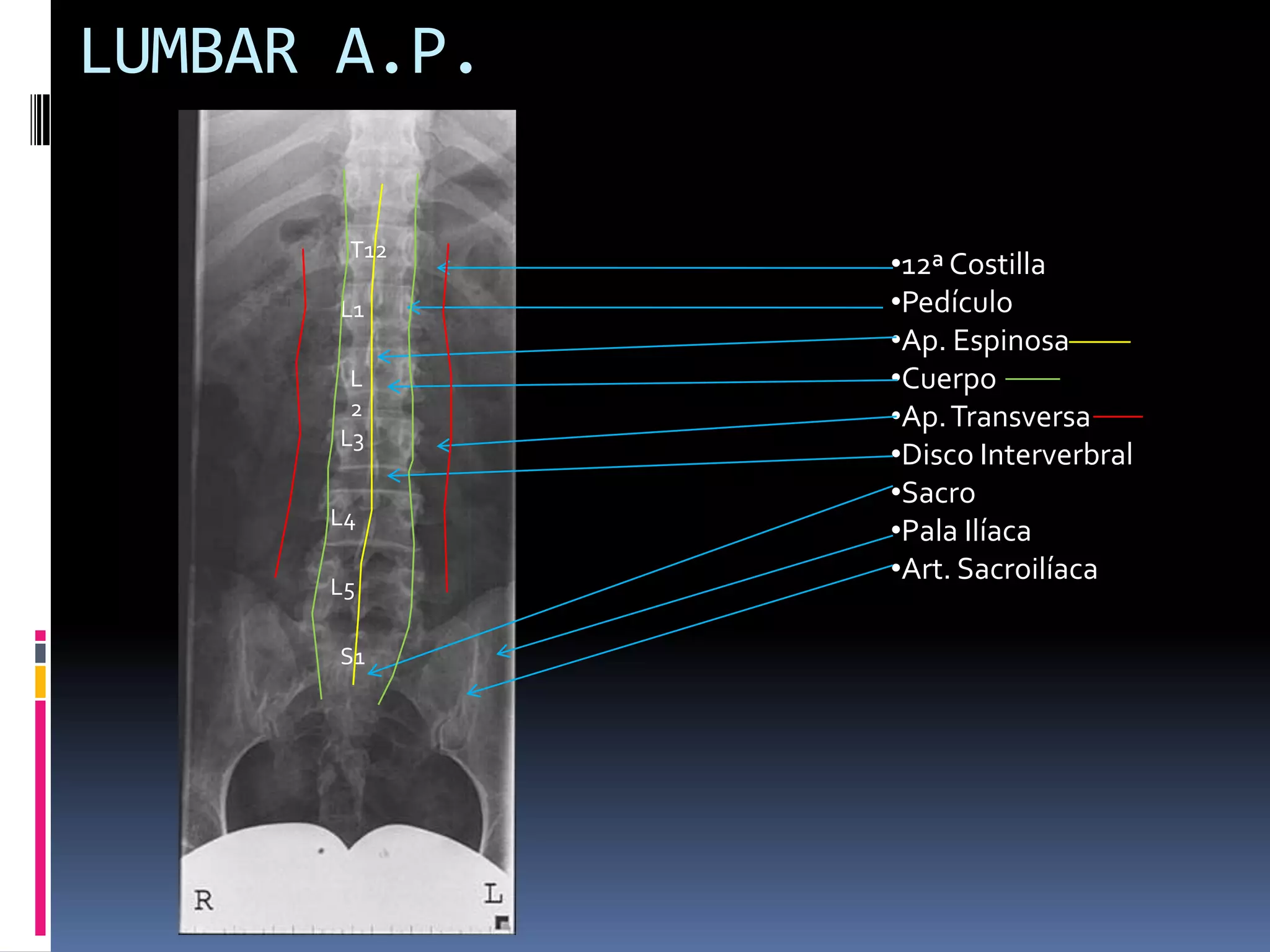 Manual rx columna vertebral | PPTX
