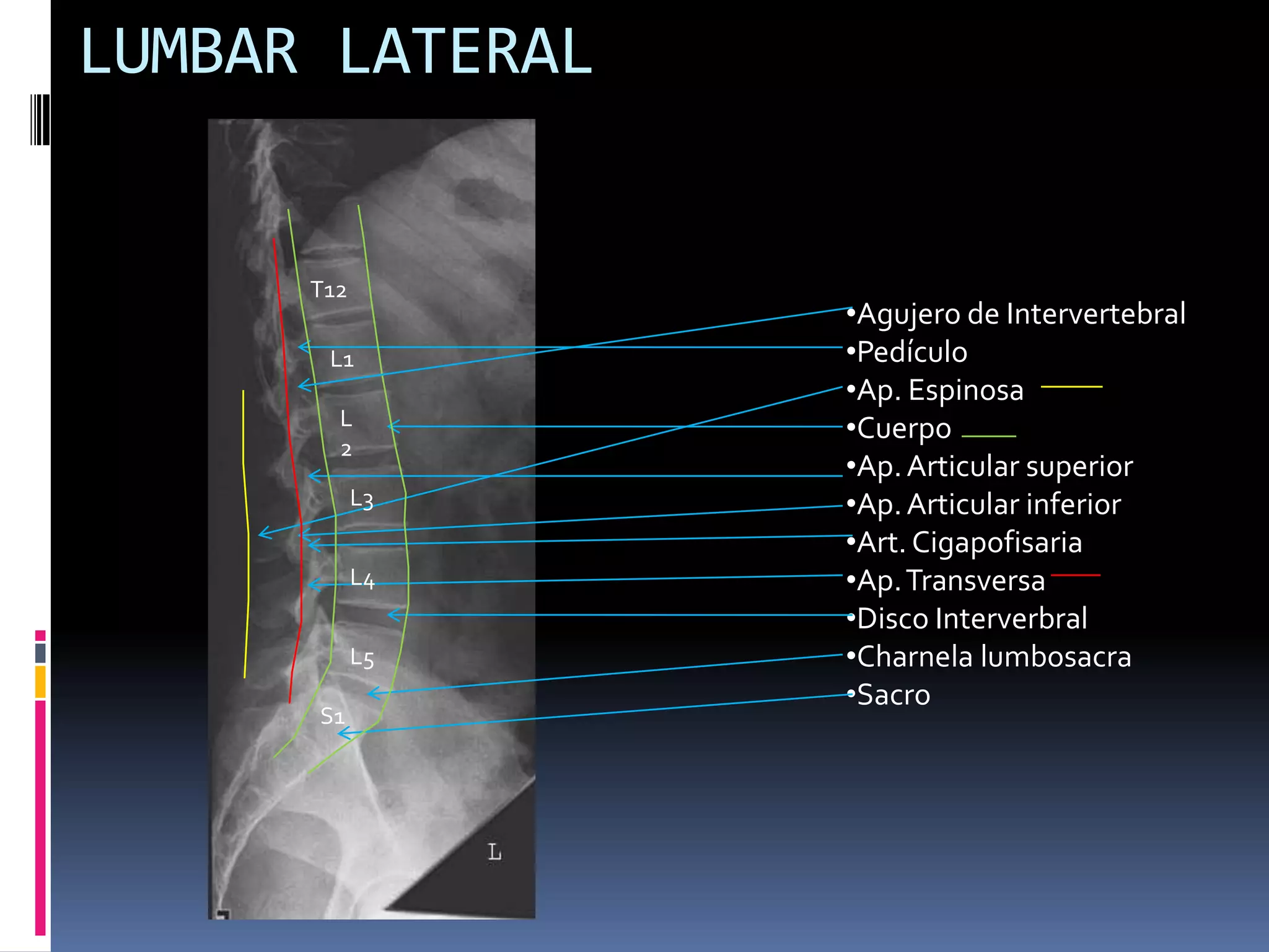 Manual rx columna vertebral | PPTX