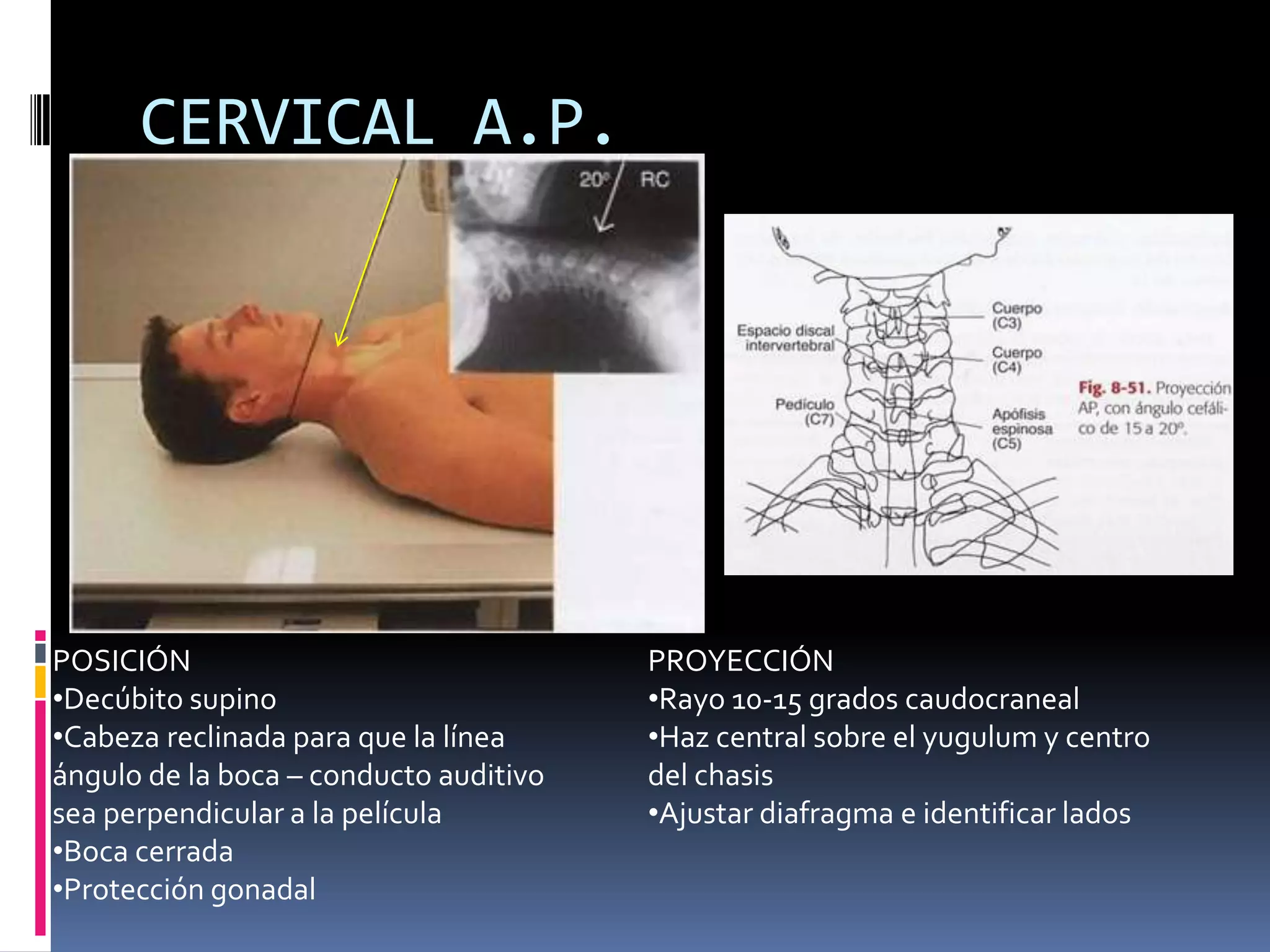 Manual rx columna vertebral | PPTX