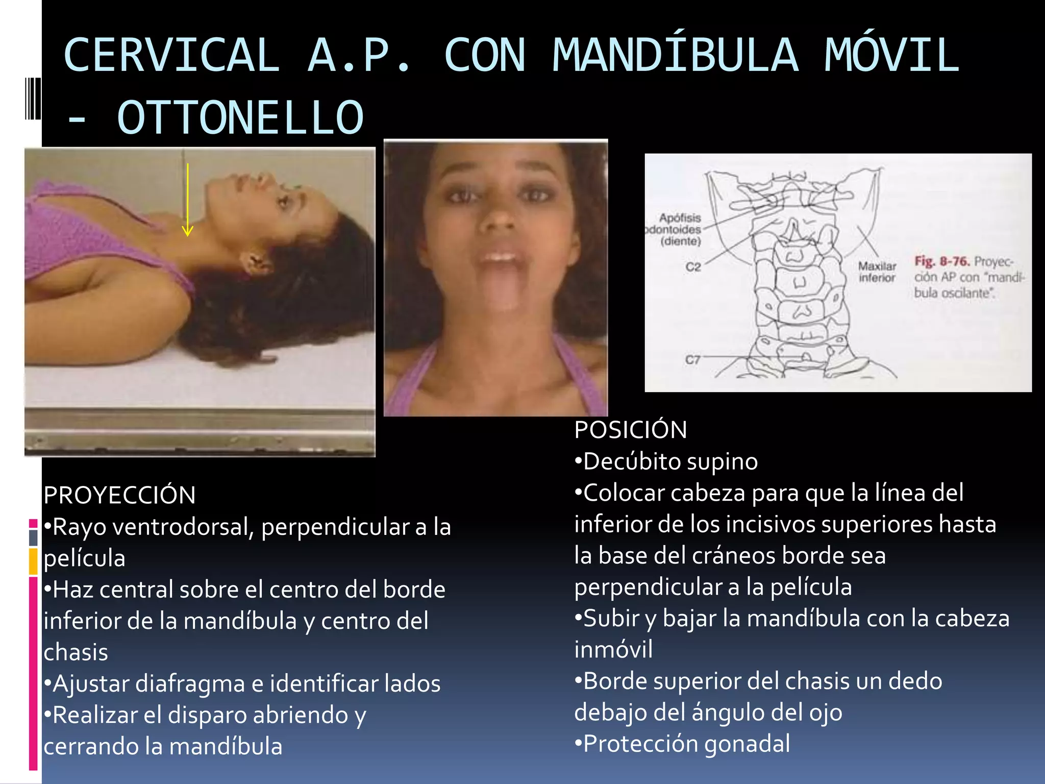 Manual rx columna vertebral