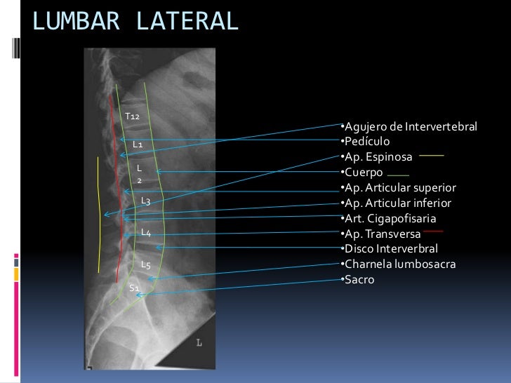 Manual rx columna vertebral