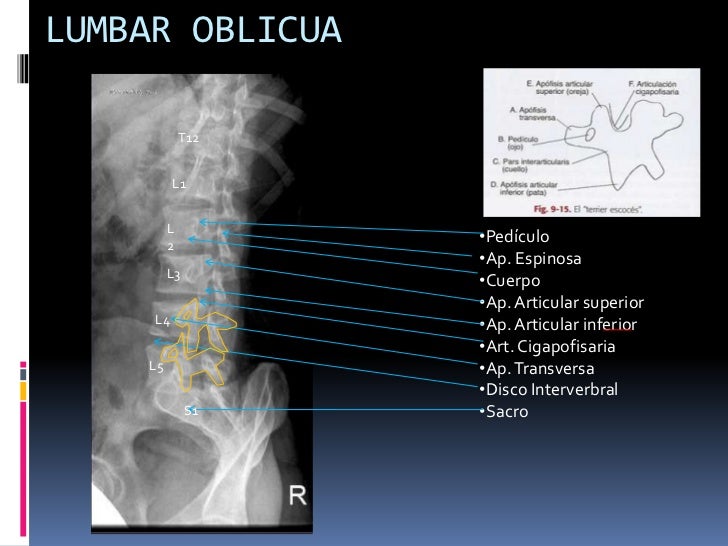 Manual rx columna vertebral