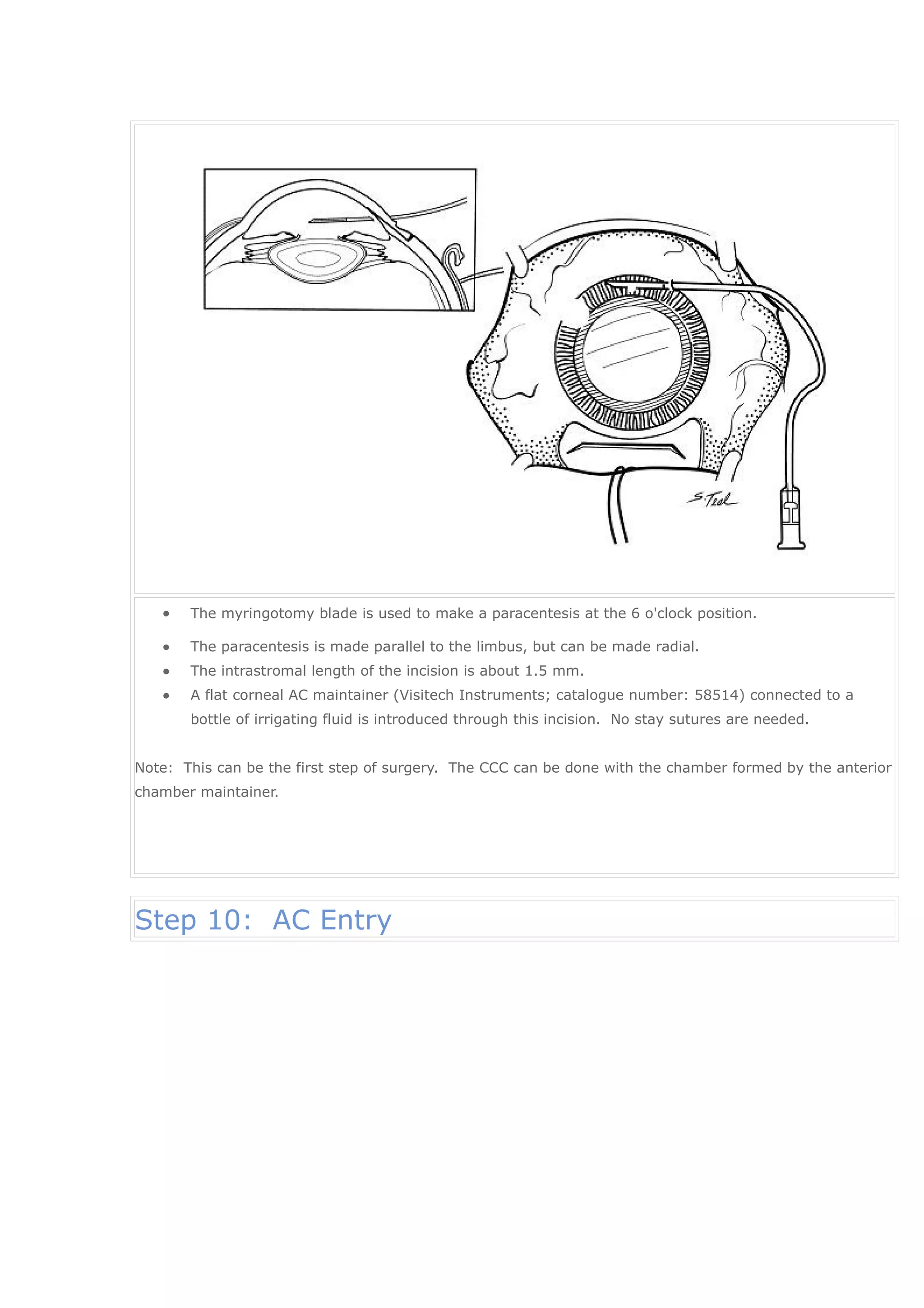 Manual small incision cataract surgery | DOC