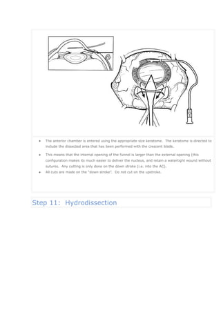 Manual small incision cataract surgery | DOC
