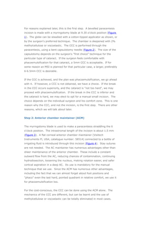Manual small incision cataract surgery | DOC