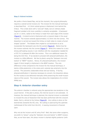 Manual small incision cataract surgery | DOC