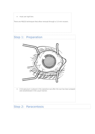 Manual small incision cataract surgery | DOC