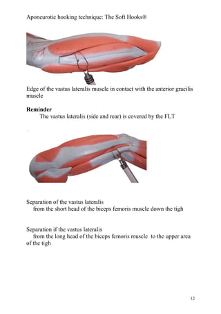 Manual soft hooks extracts | DOC | Death, Injury, or Military Conflict ...