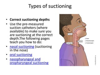 Manual Suction Machine use in hospital setting.pptx