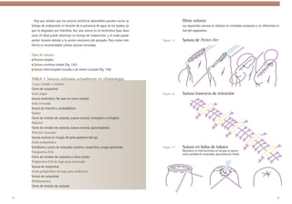 Manualsuturas | PDF