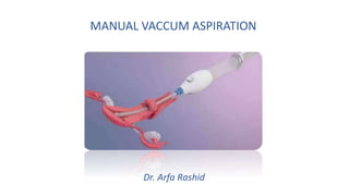 Manual Vaccum Aspiration- A step by step guide. | PPTX