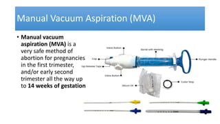 Manual Vaccum Aspiration- A step by step guide. | PPTX