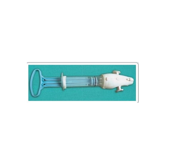 MANUAL VACUUM ASPIRATION.pptx - doct for threatened abortion | PPT