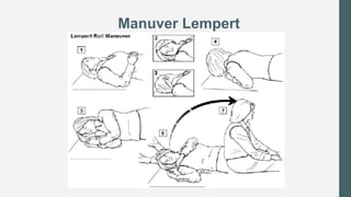 Manuver Keseimbangan.pptx