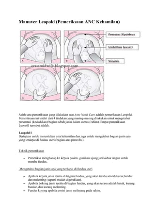 Manuver leopold | DOCX